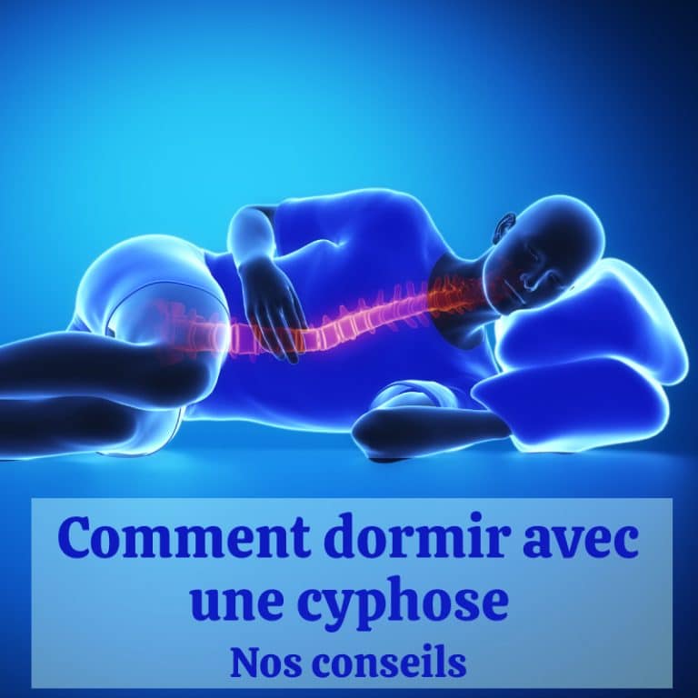 Comment dormir avec une cyphose ? Nos conseils - Sommeil.org